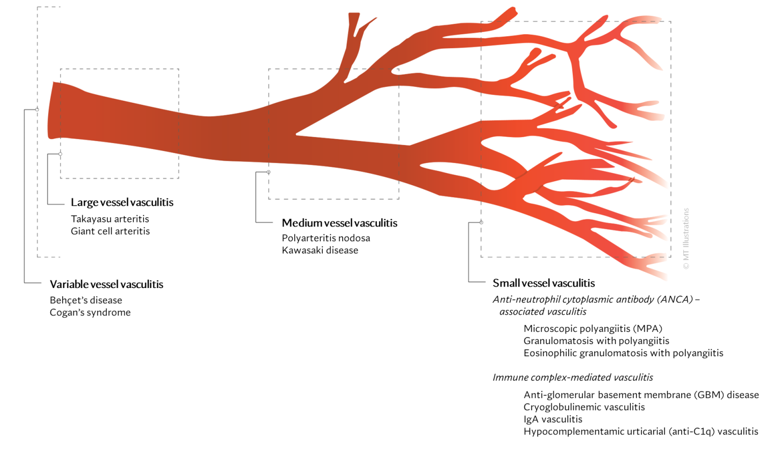 Types of Vasculitis : Johns Hopkins Vasculitis Center